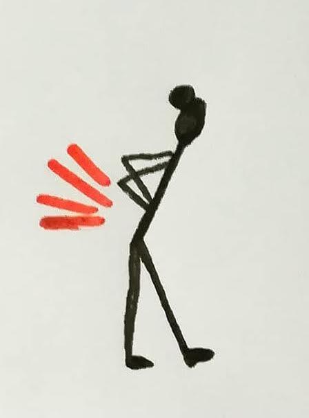 iskias ja alaselkäkipu